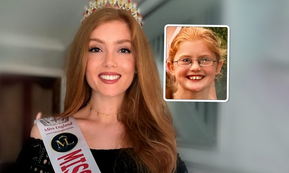 “Më kanë goditur, pështyrë”, rrëfimi i vajzës që fitoi Miss Anglia 2022 ...